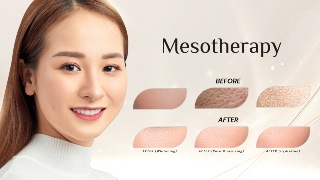 Renew Your Skin and Hair with Mesotherapy Treatment in Malaysia| Zen Clinic